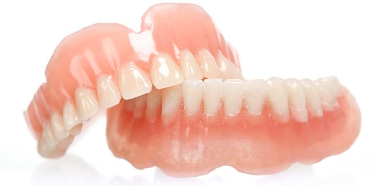 Lower Dentures Without Implants